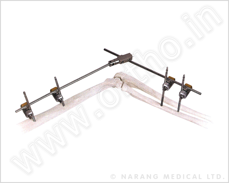 Hoffmann Type External Fixators - 5.0mm, Upper Limb, Hoffmann Type ...