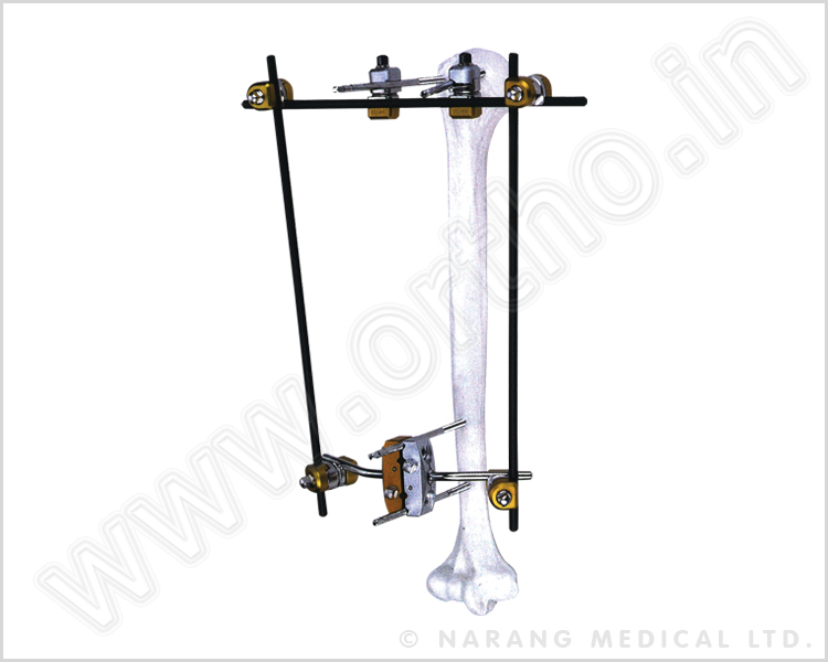 Hoffmann Type External Fixators - 5.0mm, Upper Limb, Hoffmann Type ...