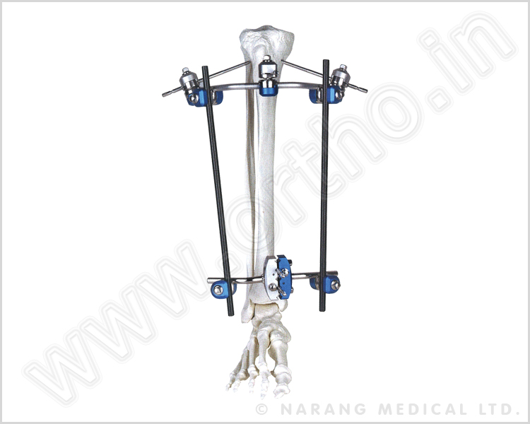 Hoffmann Type External Fixators - 8.0mm, Lower Limb, Hoffmann Type ...