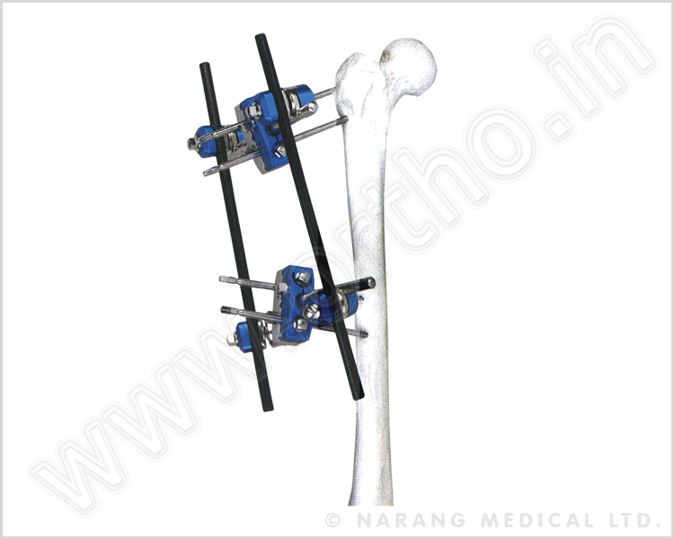 Hoffmann Type External Fixators - 8.0mm, Lower Limb, Hoffmann Type ...