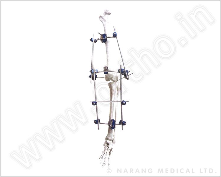Hoffmann Type External Fixators - 8.0mm, Lower Limb, Hoffmann Type ...