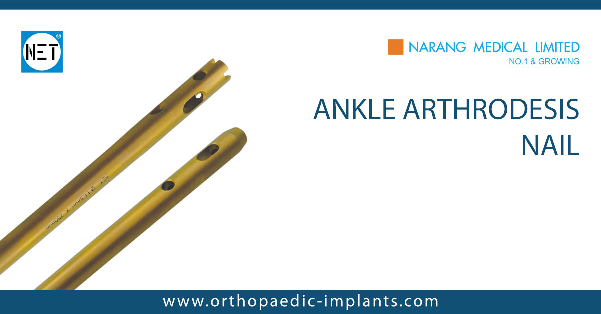 Ankle Arthrodesis Nail, Ankle Arthrodesis Nail Manufacturer, Ankle ...