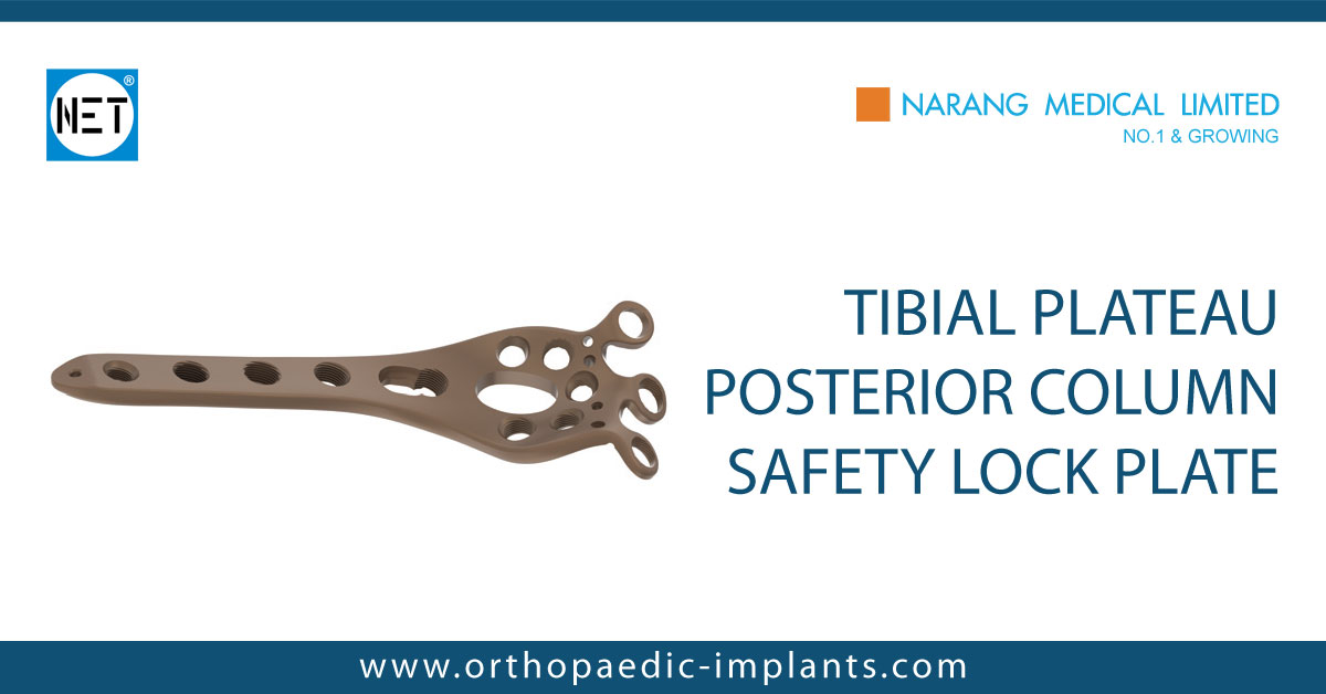 Tibial Plateau Posterior Column, Tibial Plateau Posterior Column ...