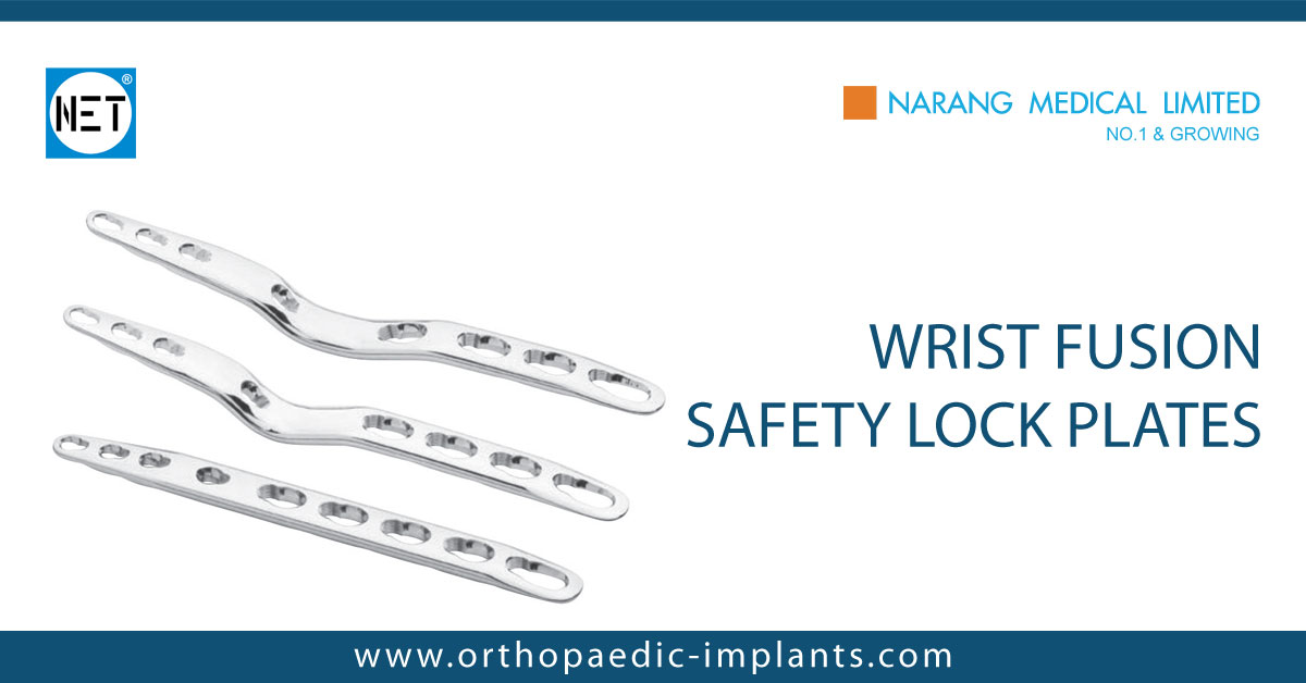 Wrist Fusion Safety Lock Plates, Wrist Fusion Safety Lock Plates ...