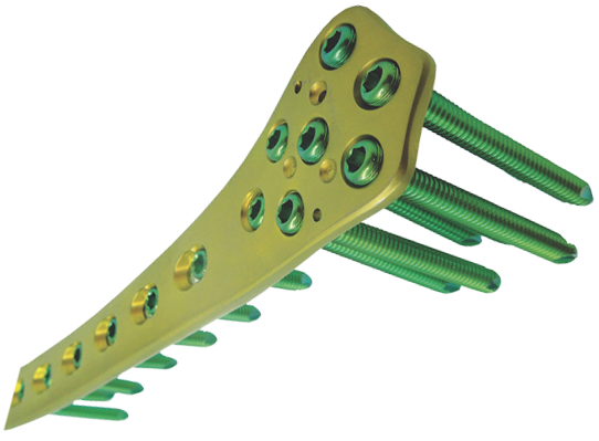 Orthopedic Implants, Orthopaedic Implants Manufacturer, Orthopedic ...