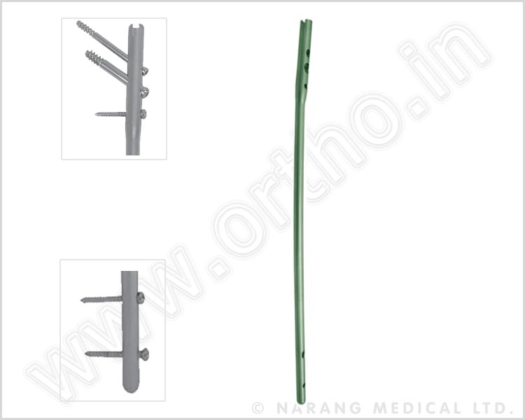 RECON Nail, RECON Nail Manufacturer, RECON Nail Suppliers, Orthopedic ...