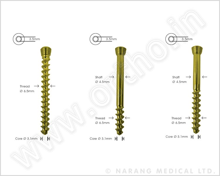 Screw - Safety Locking Implants For Large Fragment Locking Implants ...